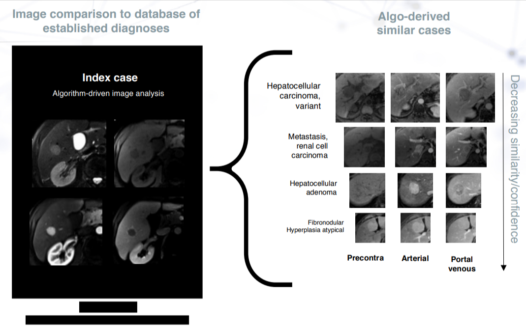Radiology Software Development with AI in Medical Imaging