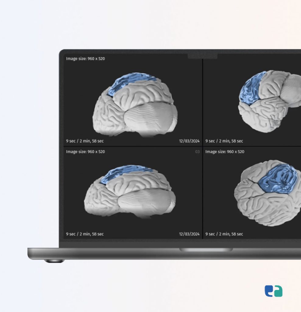 3D Medical Imaging Software Development: 2024 Guide